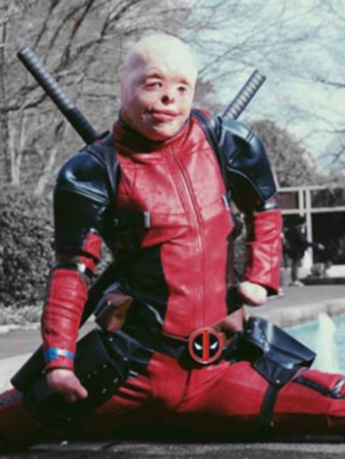 Burn Victim Cosplaying Deadpool Receives A Great Reply from Ryan Reynolds